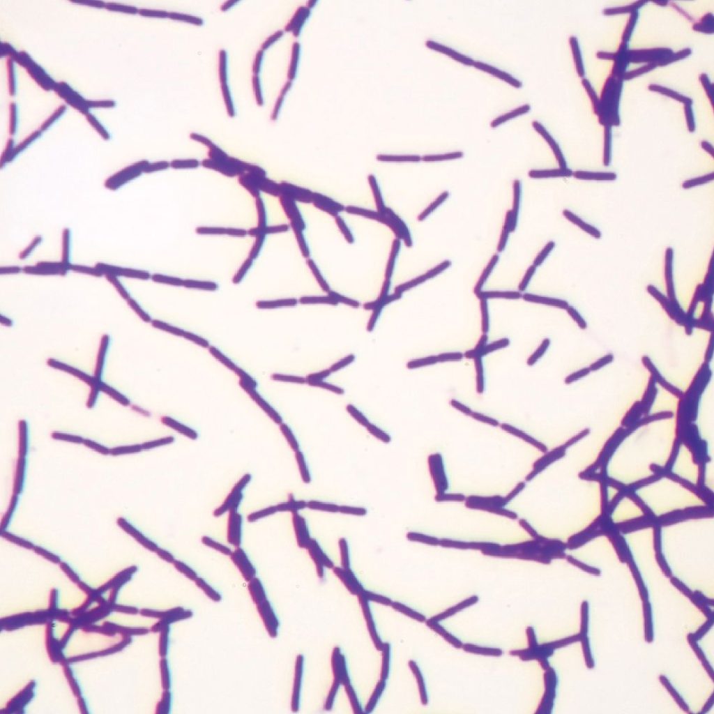 Bacterias bacilos gram positivo | Portaobjetos preparados de ...