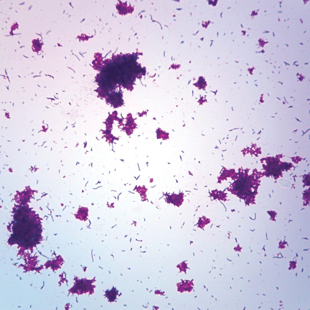 Bacterias lactobacillus y streptococcus lactis | Portaobjetos ...